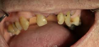 DRUGI PIŠU-LOŠ ZADAH NIJE POSLEDICA SAMO POKVARENIH ZUBA: Otkrivamo ...